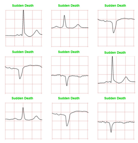 An Embedded System Using Convolutional Neural Network Model for Online ...