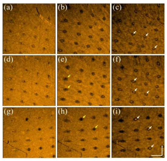In Vivo Identification of Skin Photodamage Induced by Fractional CO2 ...