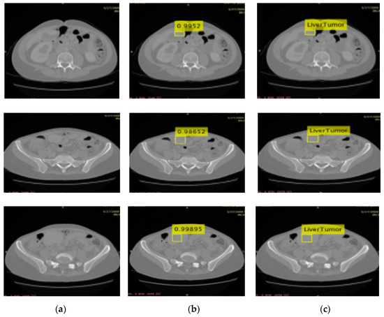 Diagnostics | Free Full-Text | Liver Tumor Localization Based on YOLOv3 and 3D-Semantic ...