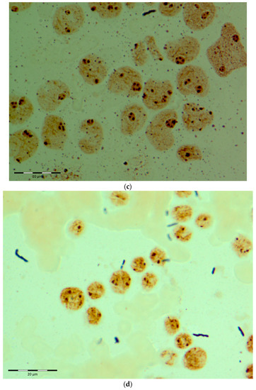 Analysis of Argyrophilic Nucleolar Organizer Regions (AgNORs) in Acute ...