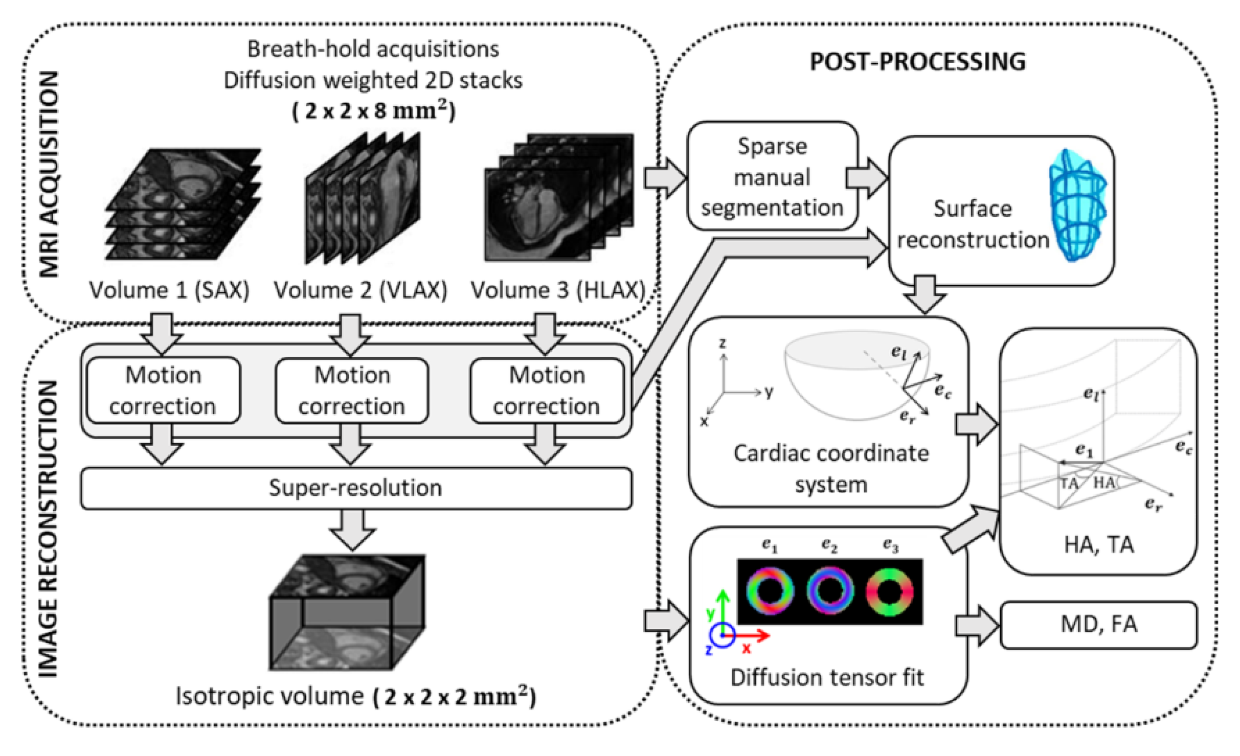 In Vivo Super-Resolution Cardiac Diffusion Tensor MRI: A Feasibility Study