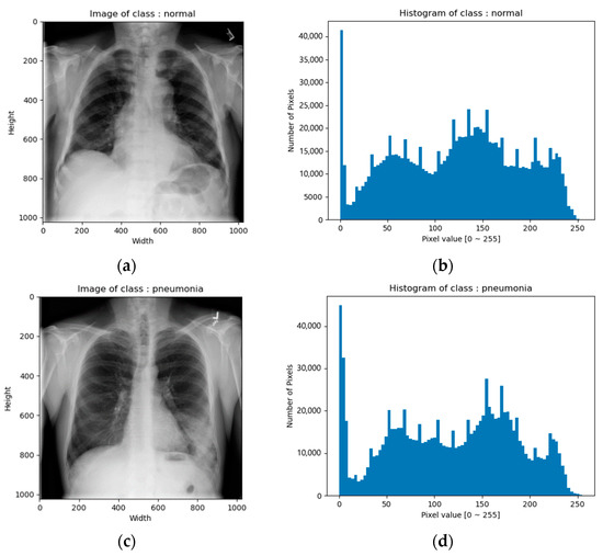 Deep Learning in Multi-Class Lung Diseases’ Classification on Chest X ...