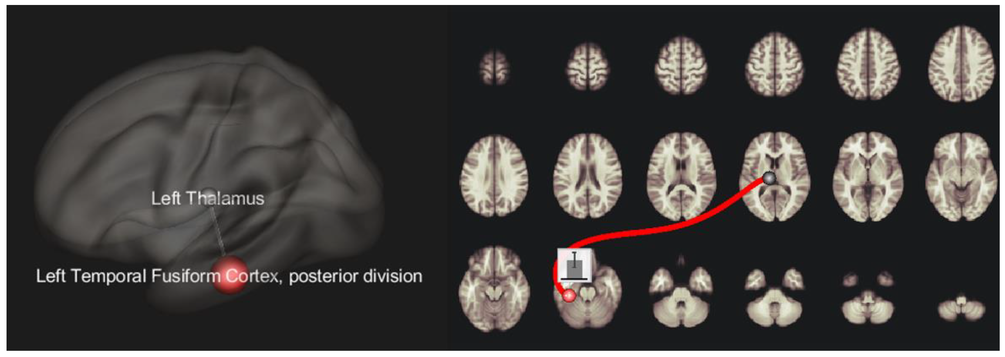 Brain Networks Involved in Depression in Patients with Frontotemporal ...