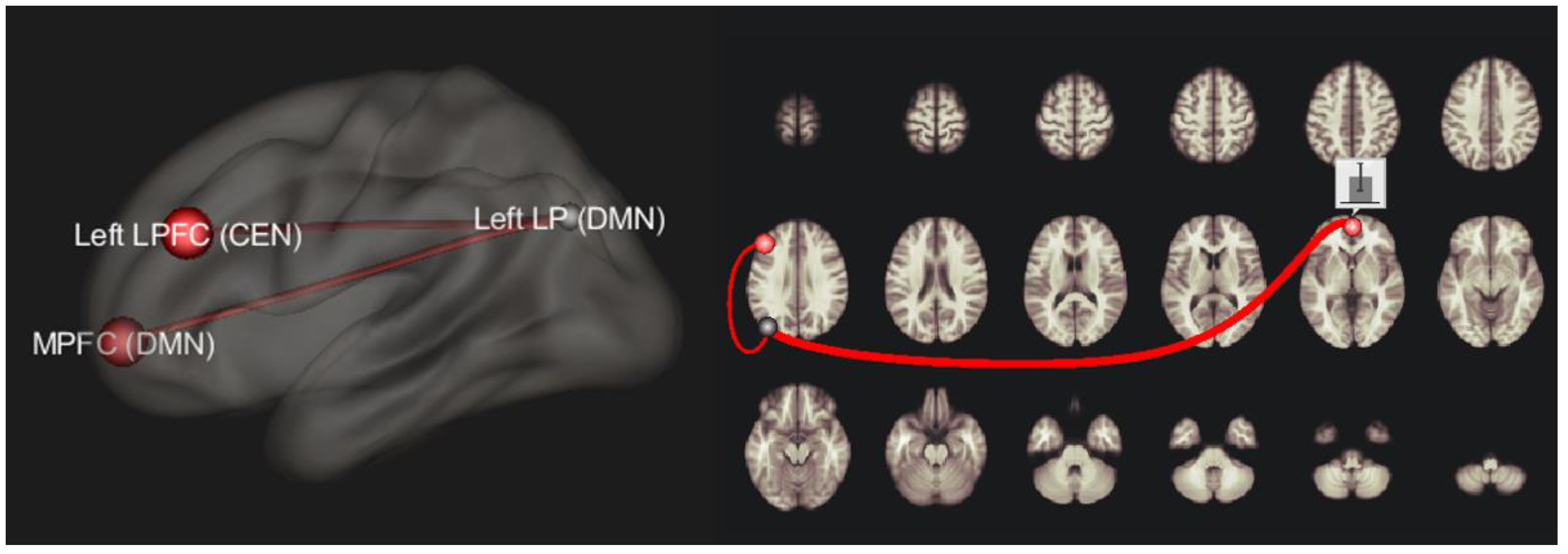 Brain Networks Involved in Depression in Patients with Frontotemporal ...