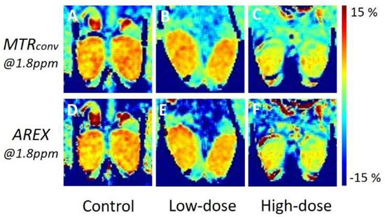 Medical Image Analysis