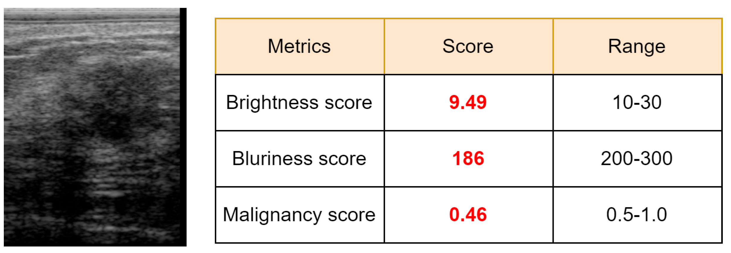 Predicting Breast Tumor Malignancy Using Deep ConvNeXt Radiomics and ...