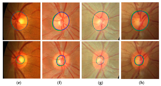 Identifying Those at Risk of Glaucoma: A Deep Learning Approach for ...