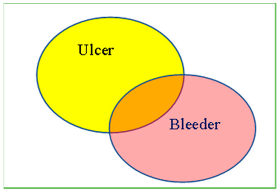 Forrest Classification for Bleeding Peptic Ulcer: A New Look at the Old ...
