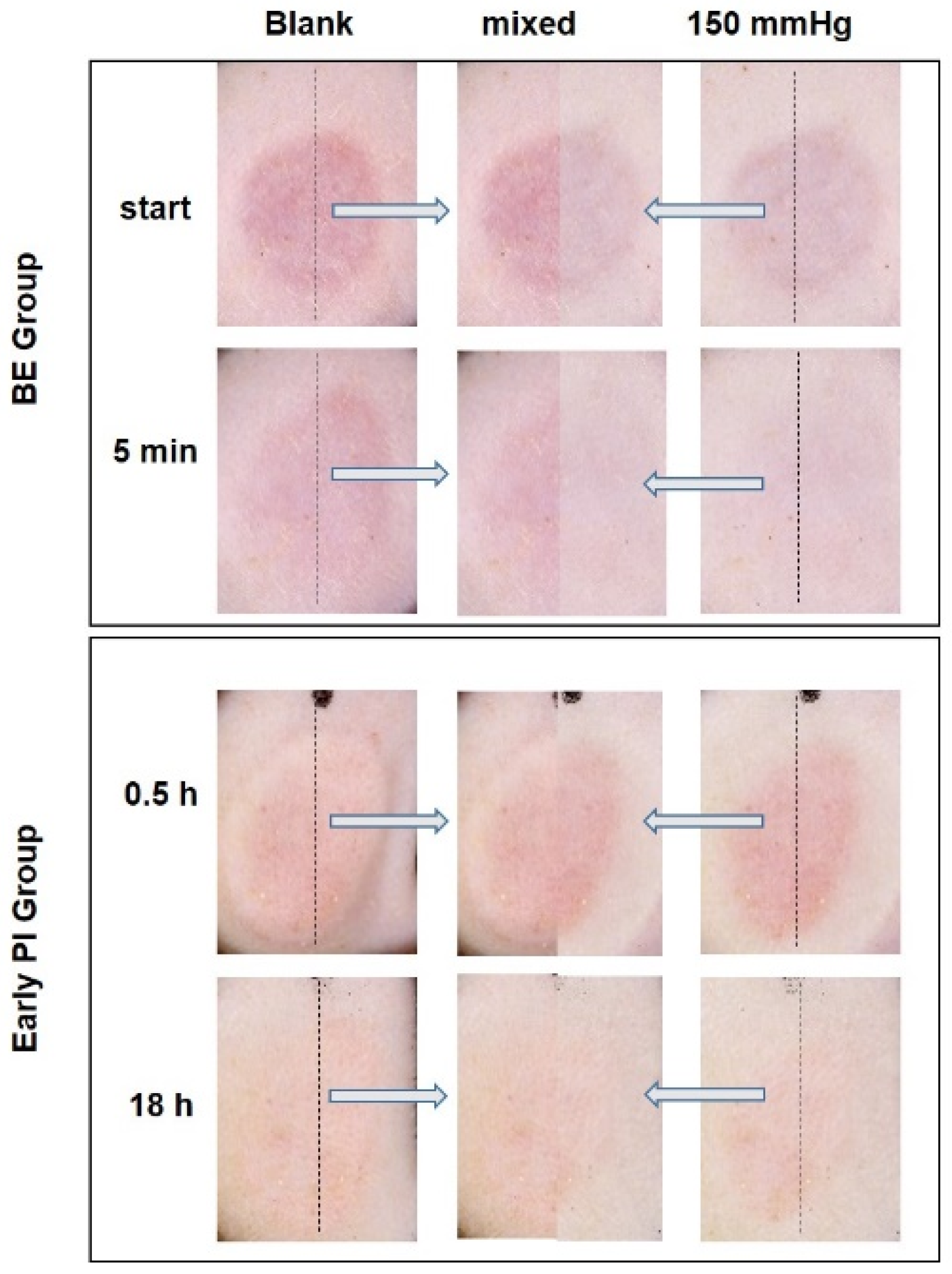 Diagnostics | Free Full-Text | Establishing an Appropriate Pressure for ...