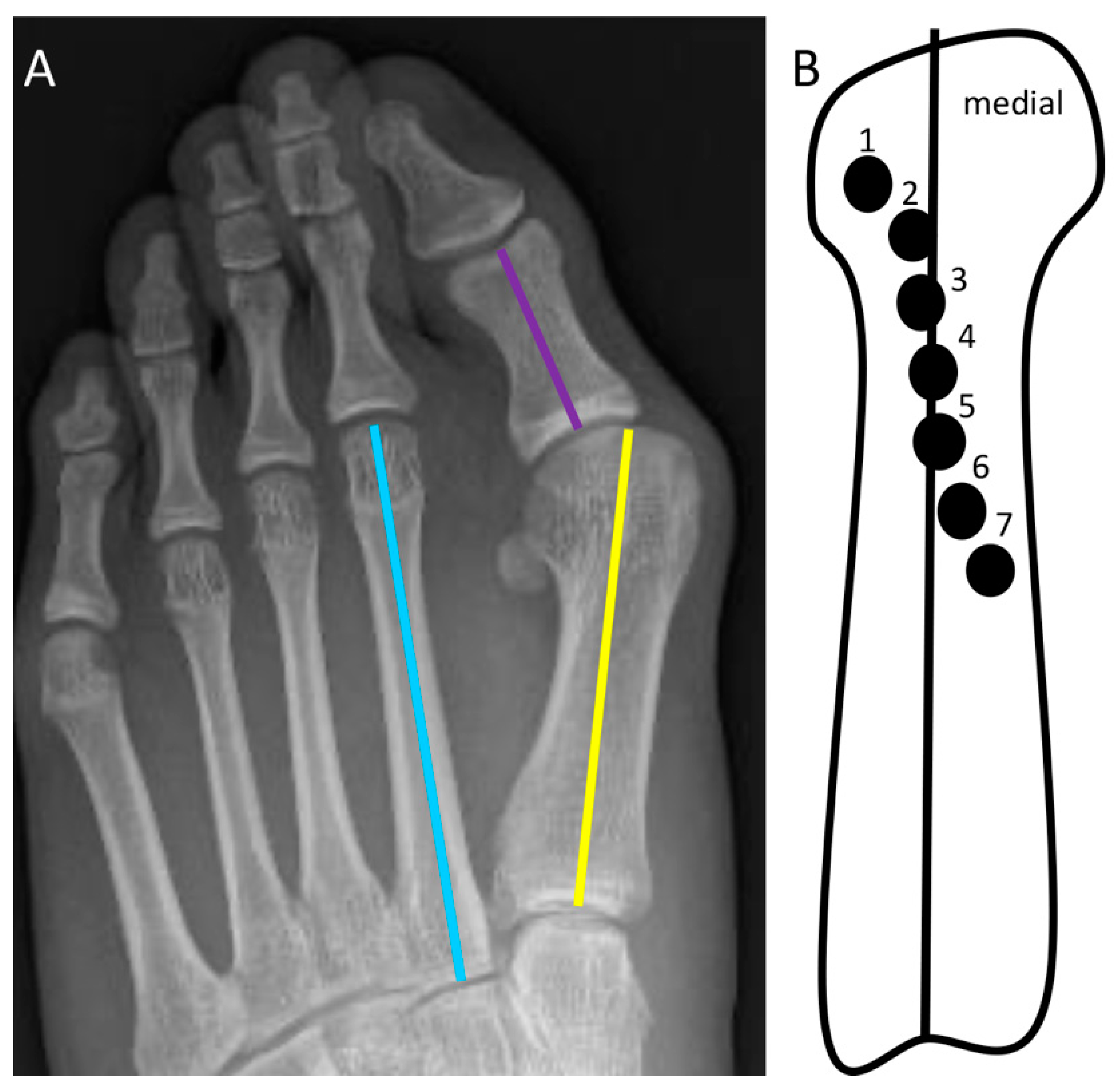 Normal Pediatric Ankle Xray