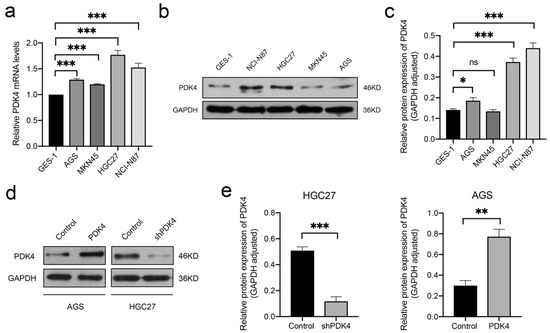 PDK4 Constitutes a Novel Prognostic Biomarker and Therapeutic Target in ...