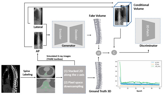 Generative Adversarial Network (GAN) for Automatic Reconstruction of ...