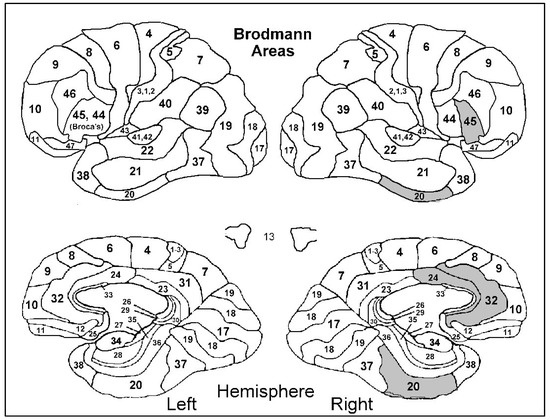 Brodmann Area 22