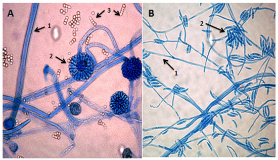 Necrotizing Skin and Soft Tissue Infection Due to Syncephalastrum ...