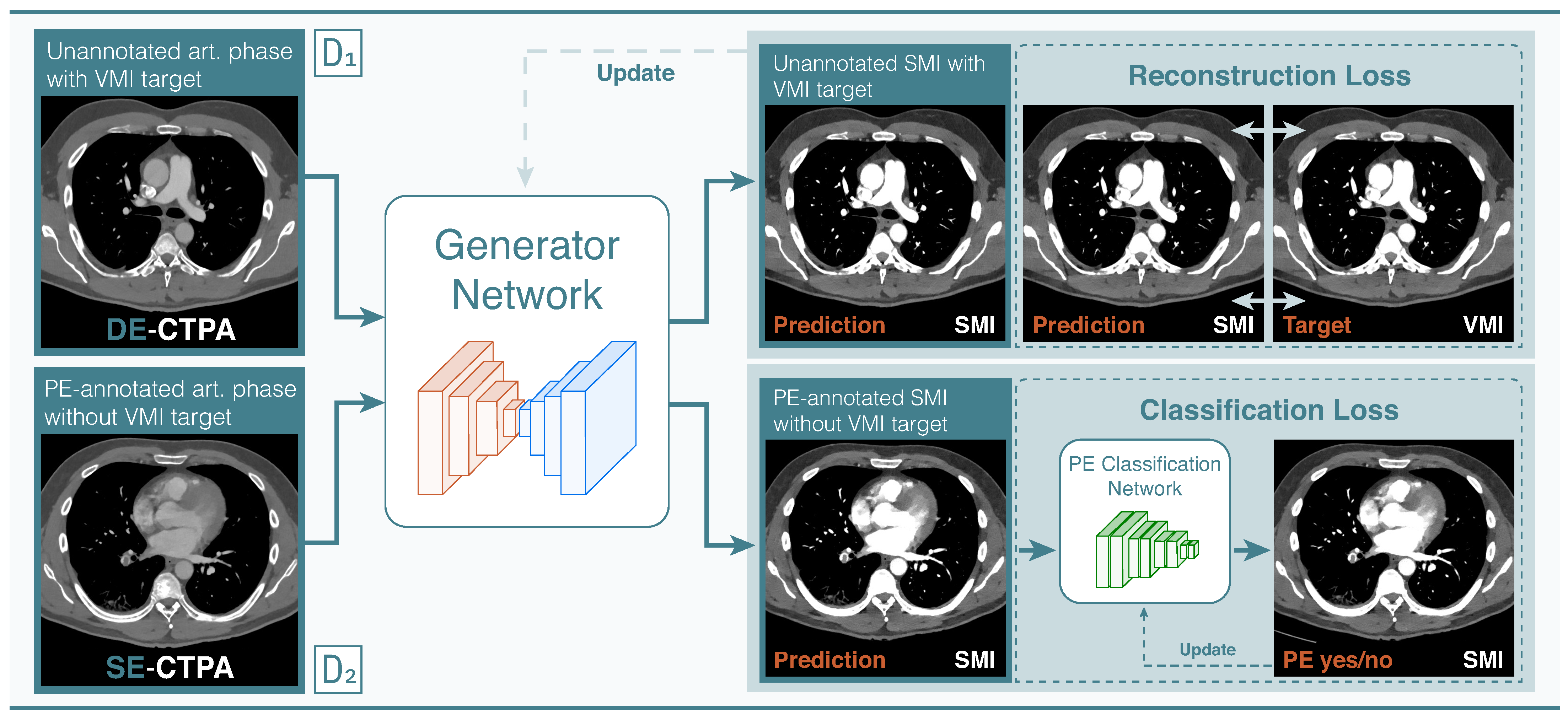 Jointly Optimized Deep Neural Networks to Synthesize Monoenergetic Images from Single-Energy CT ...