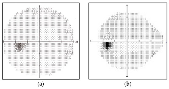 A Comprehensive Performance Analysis of Transfer Learning Optimization ...