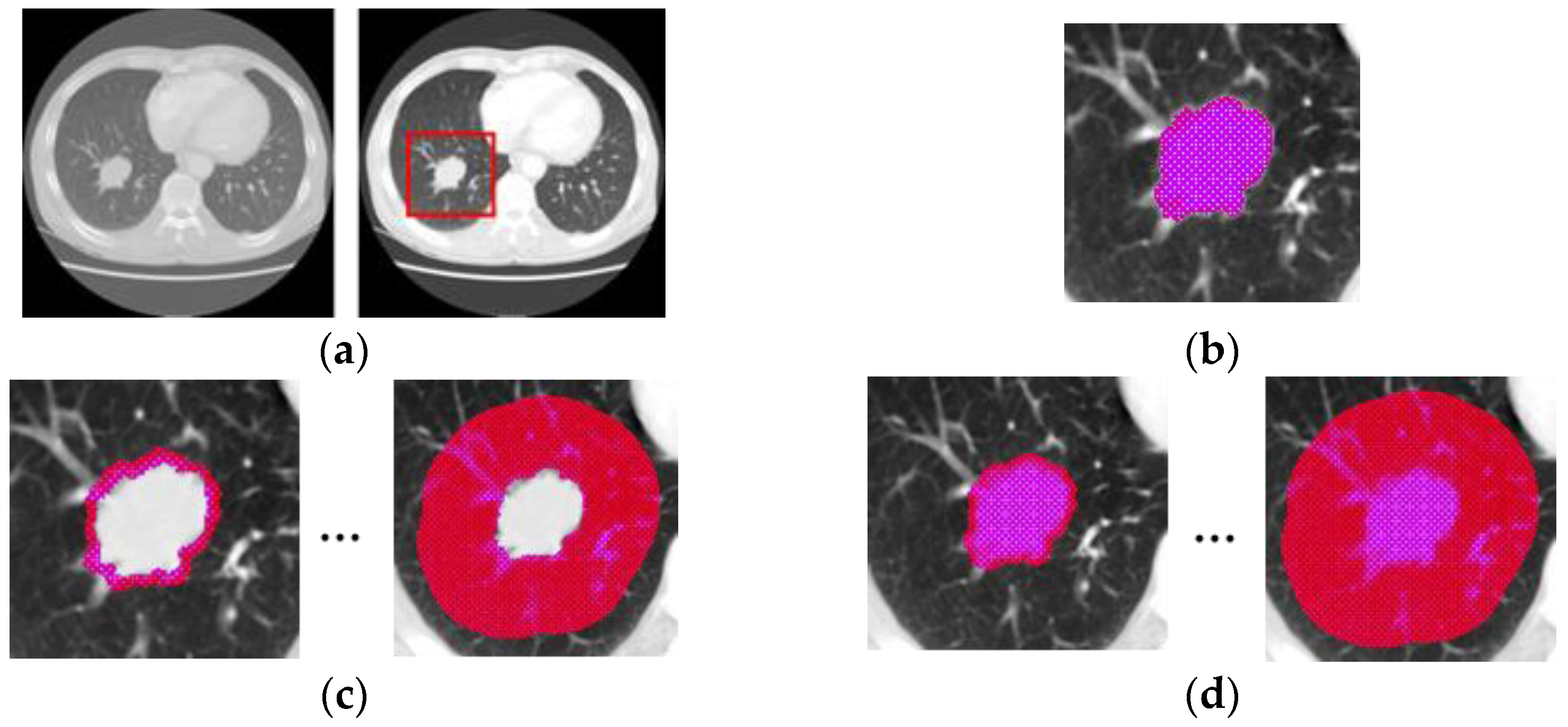 Diagnostics | Free Full-Text | Prediction of Two-Year Recurrence-Free ...