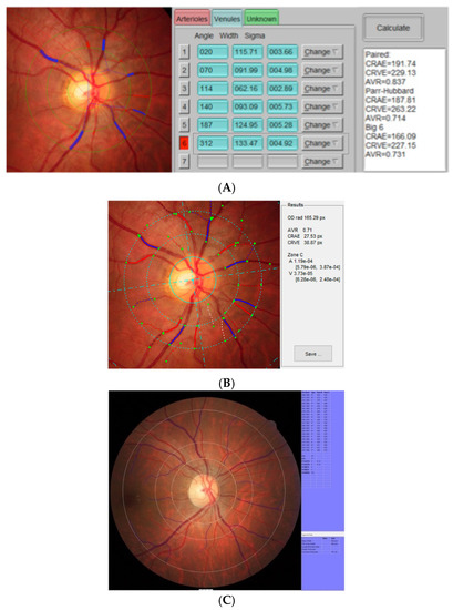Concordance between SIVA, IVAN, and VAMPIRE Software Tools for Semi ...