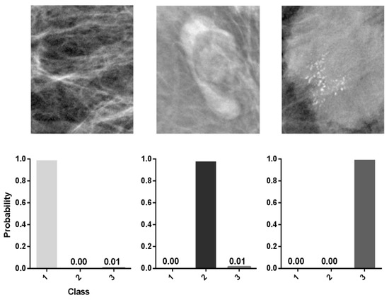 Detecting Abnormal Axillary Lymph Nodes On Mammograms Using A Deep Convolutional Neural Network