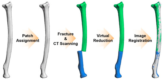 Quantitative Assessment of the Restoration of Original Anatomy after 3D ...