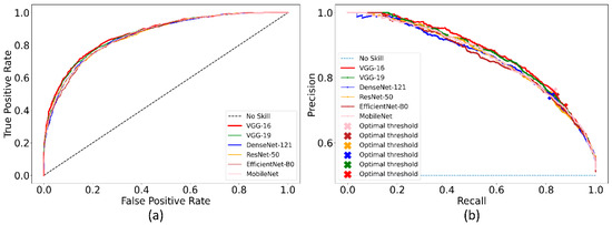 A Deep Modality-Specific Ensemble for Improving Pneumonia Detection in ...