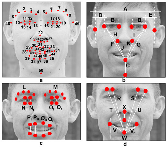 Automatic Facial Palsy Diagnosis as a Classification Problem Using ...