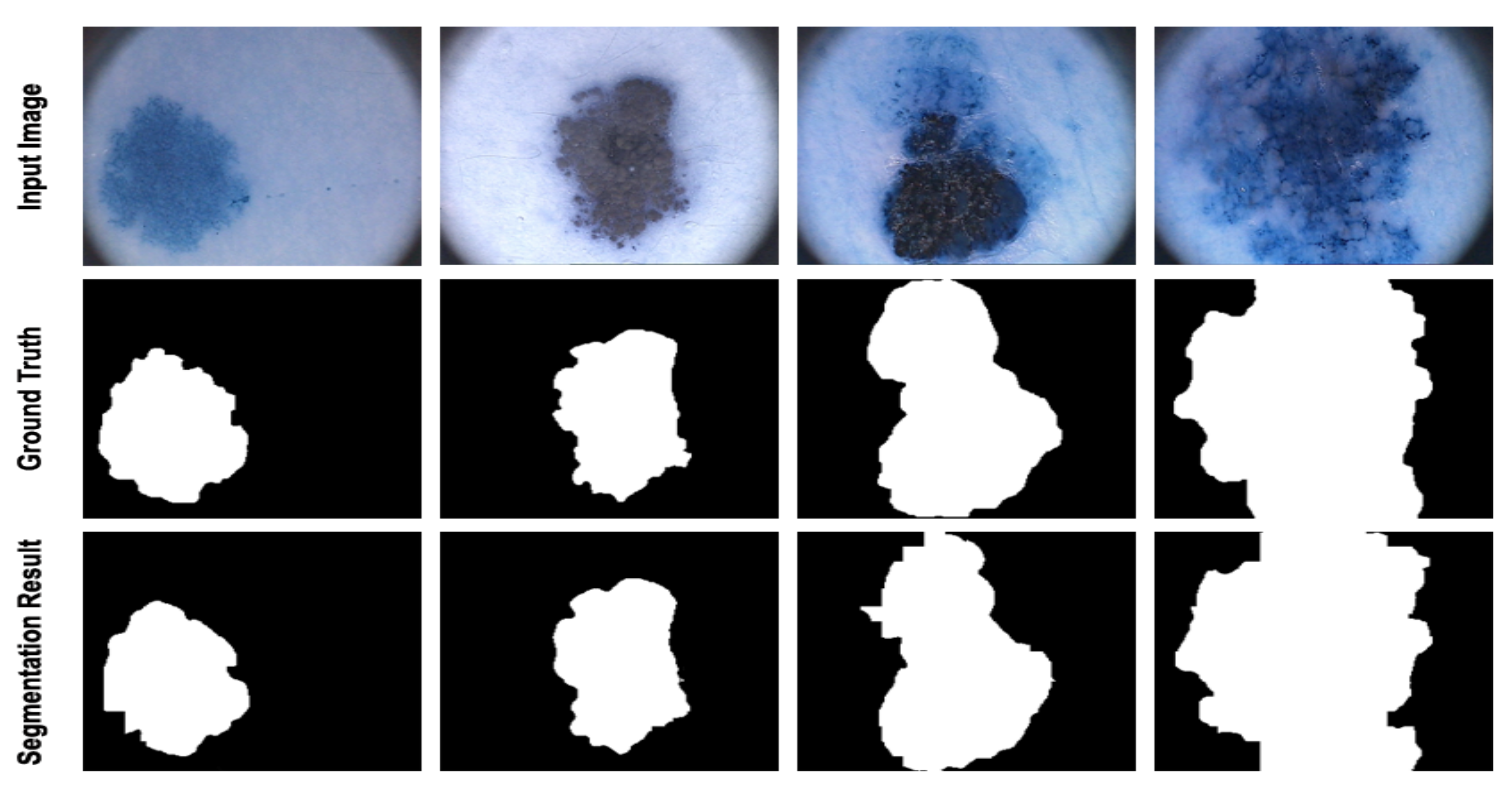 Diagnostics | Free Full-Text | Medical Image Segmentation with Learning ...