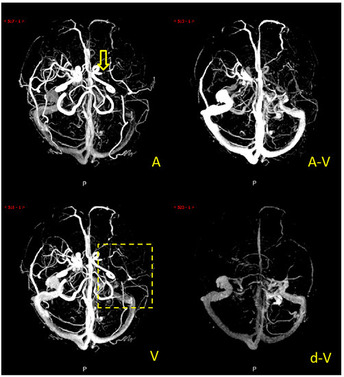 Merging Multiphase CTA Images and Training Them Simultaneously with a ...
