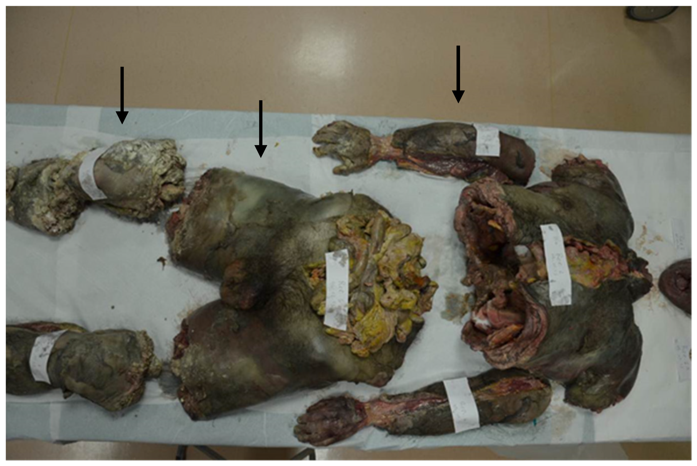 Diagnostics Free Full Text The Role Of Forensic Investigation In An