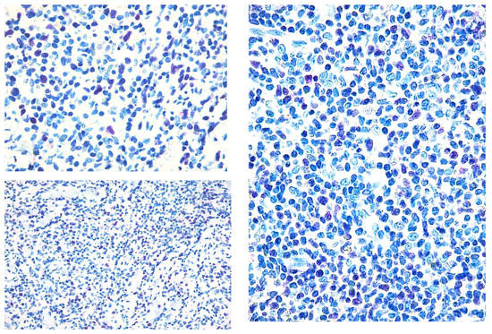 Diagnostics | Special Issue : The Role of Immunohistochemistry in the ...