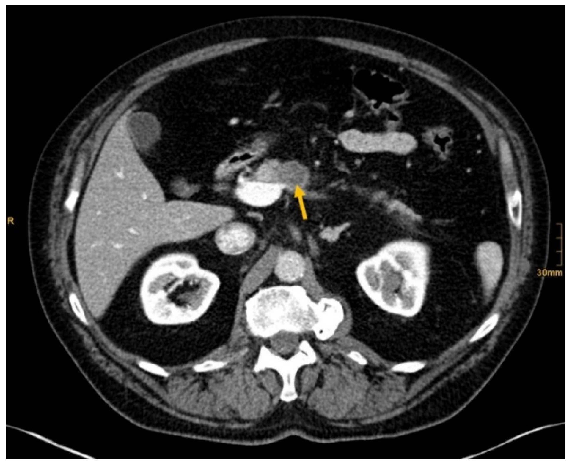 Value of Clinical Information on Radiology Reports in Oncological Imaging