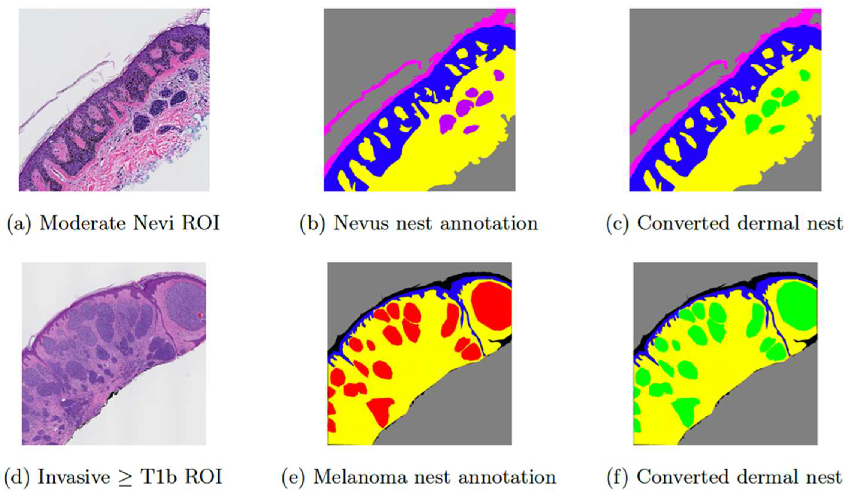 Diagnostics Free Full Text Improving The Diagnosis Of Skin Biopsies