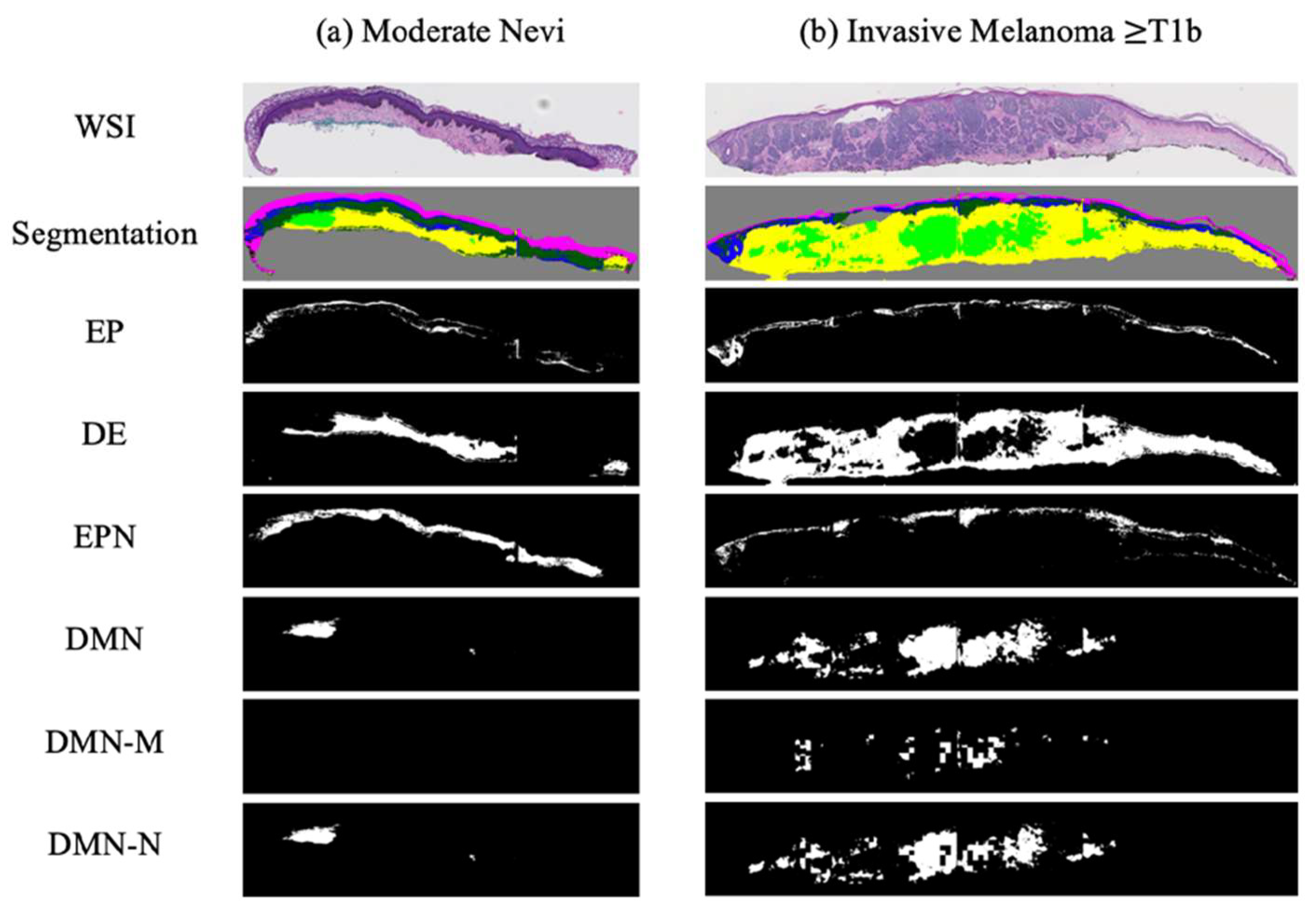 Diagnostics Free Full Text Improving The Diagnosis Of Skin Biopsies