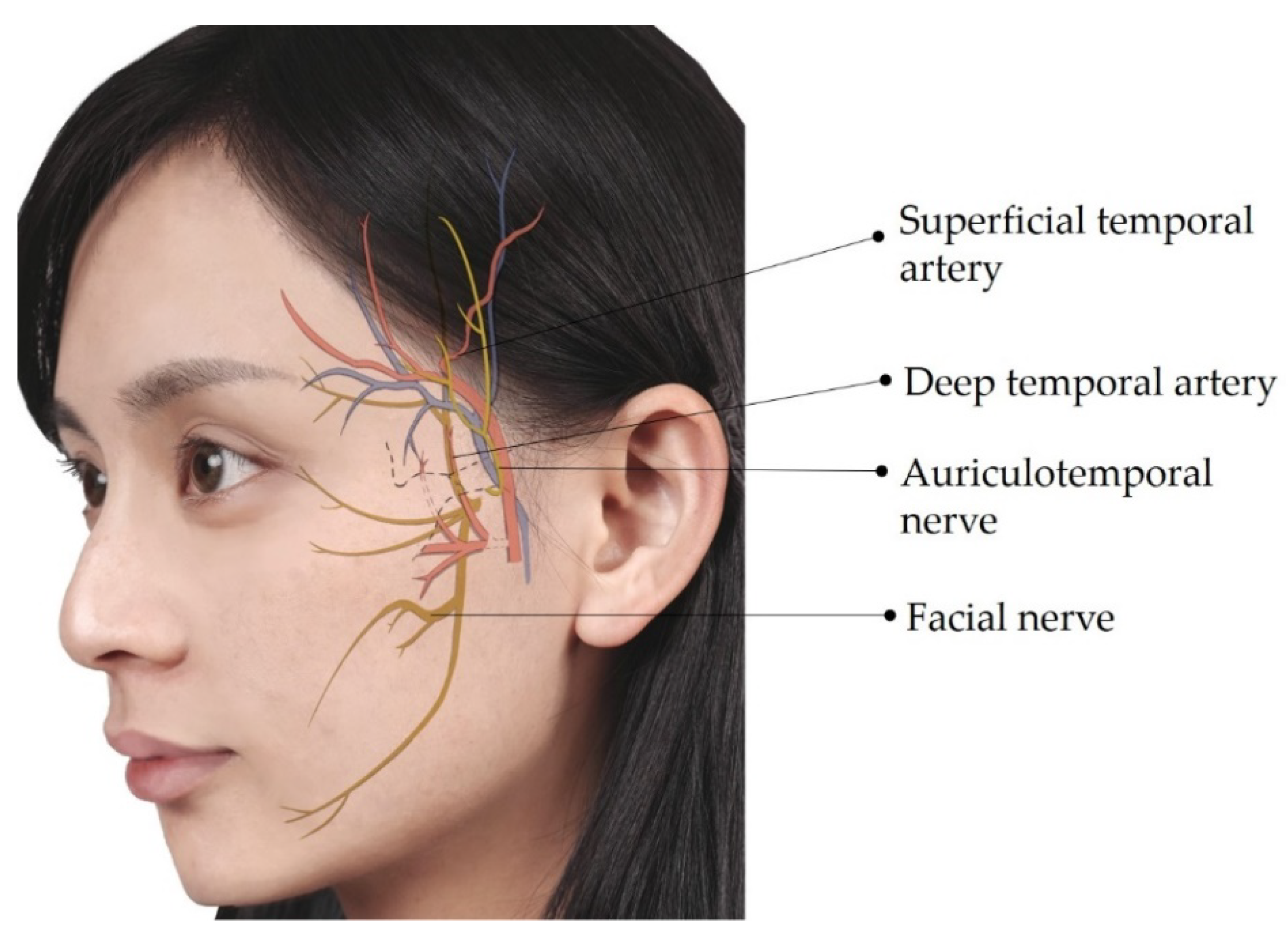 Ultrasound Imaging of Facial Vascular Neural Structures and Relevance ...