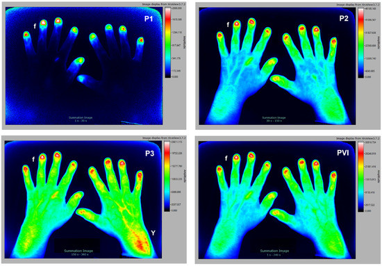 Diagnostics | An Open Access Journal from MDPI