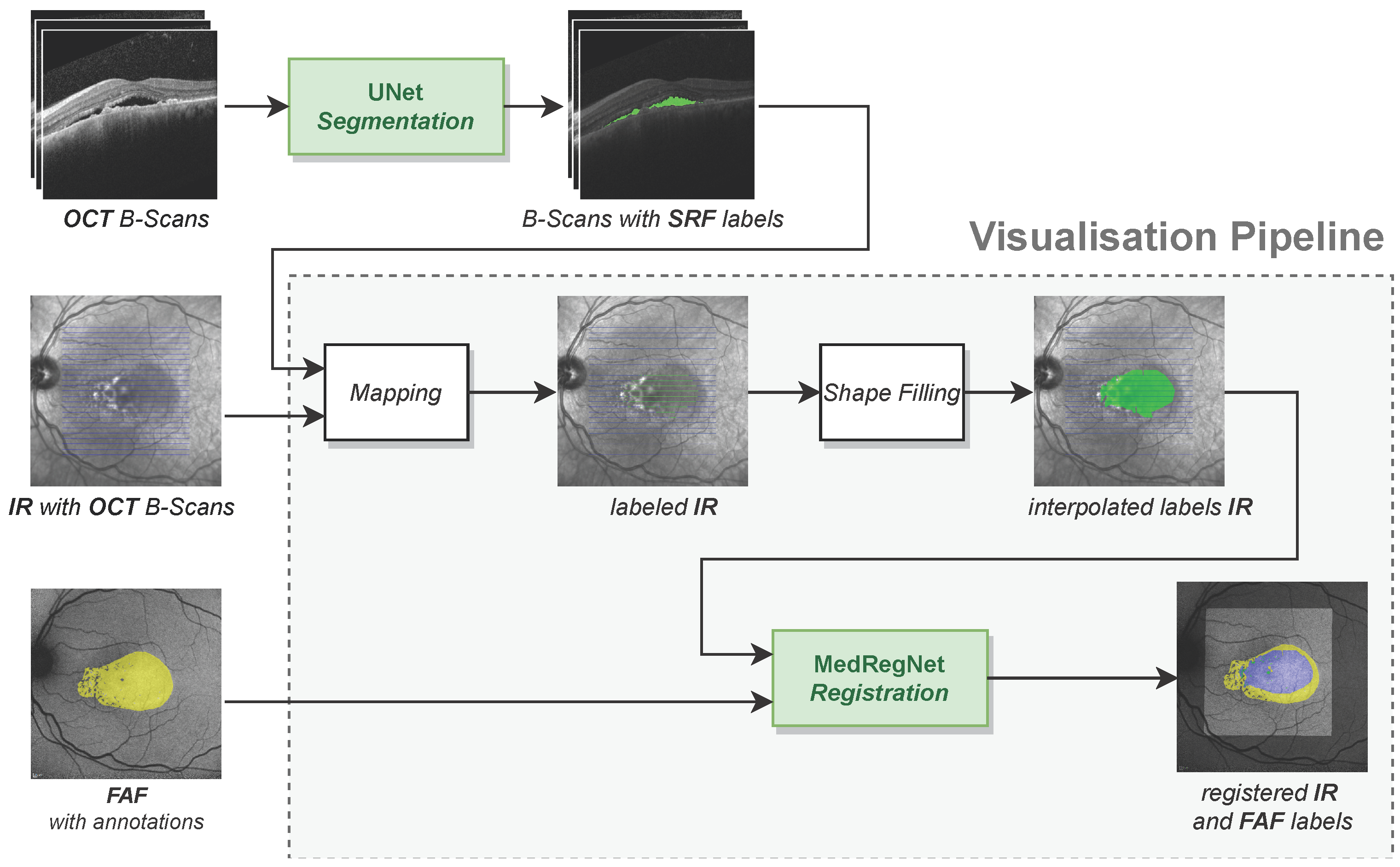 Diagnostics | Free Full-Text | Chronological Registration of OCT and ...