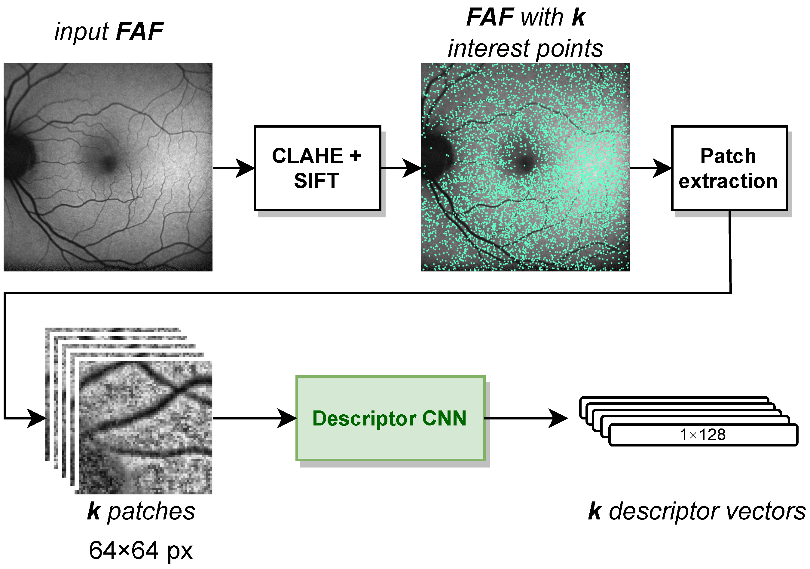 Chronological Registration of OCT and Autofluorescence Findings in CSCR ...