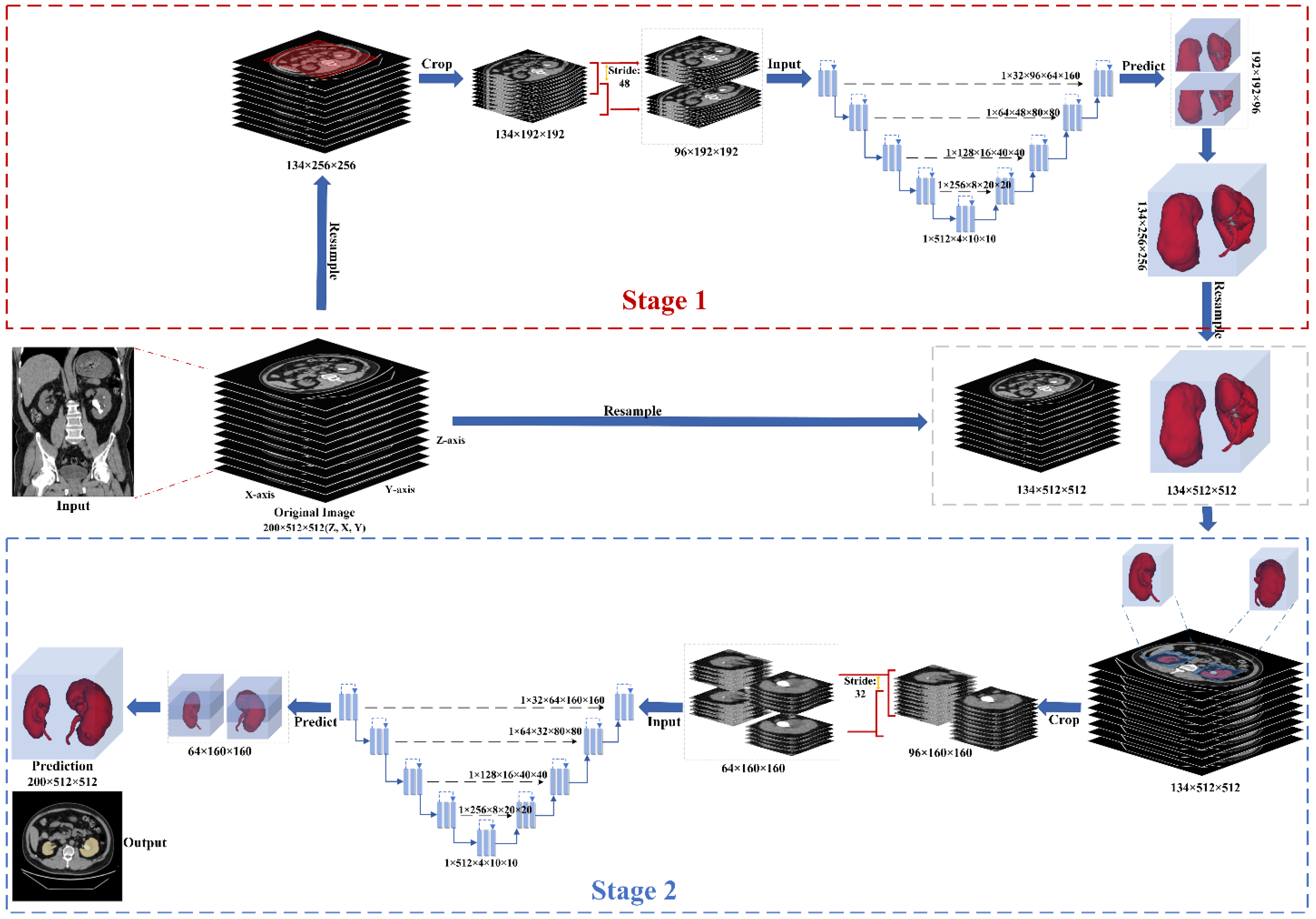 Deep Segmentation Networks for Segmenting Kidneys and Detecting Kidney Stones in Unenhanced ...