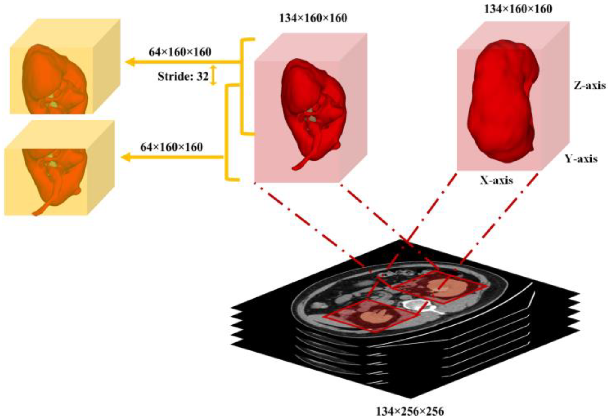 Deep Segmentation Networks for Segmenting Kidneys and Detecting Kidney Stones in Unenhanced ...