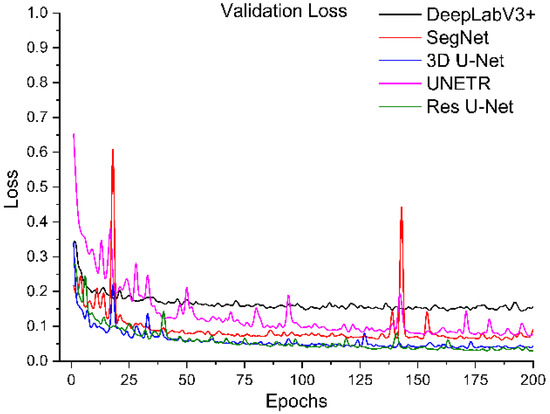 Deep Segmentation Networks for Segmenting Kidneys and Detecting Kidney Stones in Unenhanced ...