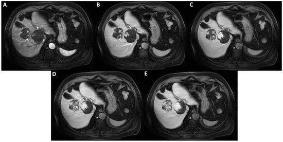 Diagnostics | An Open Access Journal from MDPI