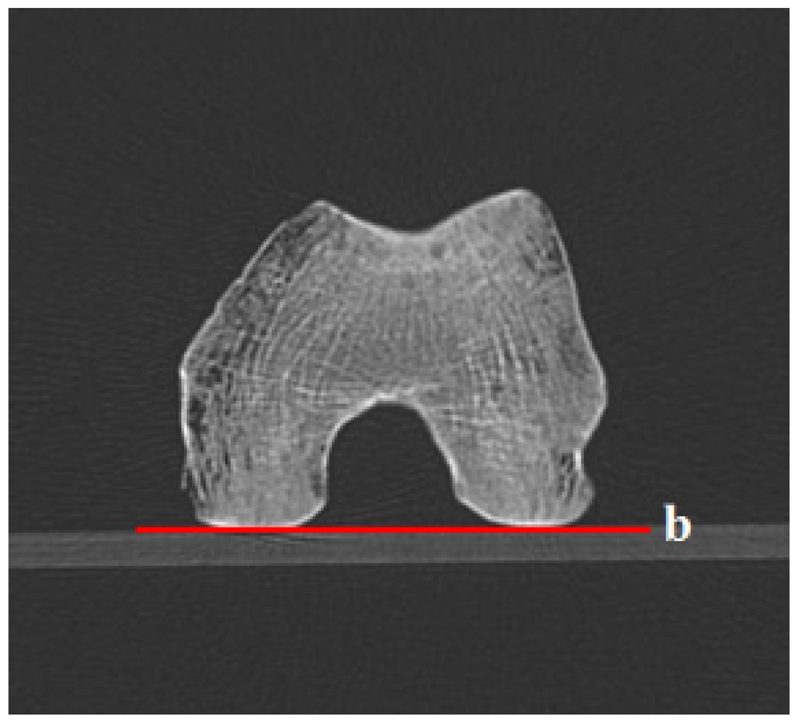 Diagnostics | Free Full-Text | Using the Axial Oblique View of Computed ...