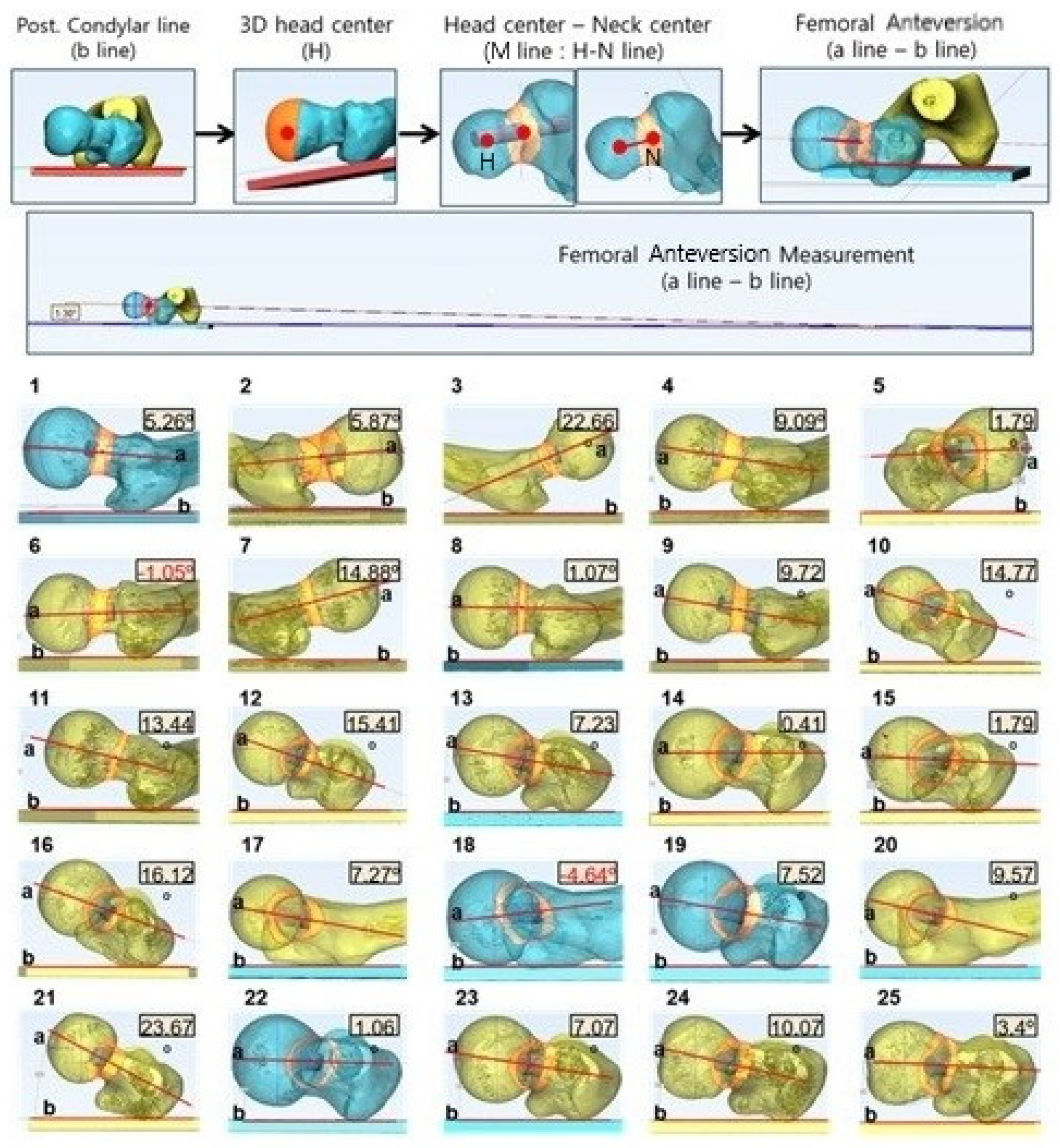 Using the Axial Oblique View of Computed Tomography (CT) in Evaluating ...