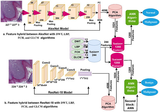 Early Diagnosis of Oral Squamous Cell Carcinoma Based on ...