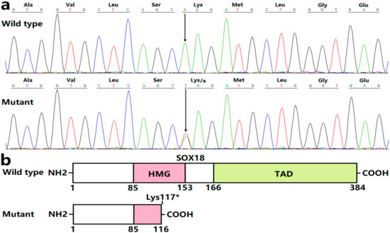 Identification of SOX18 as a New Gene Predisposing to Congenital Heart ...