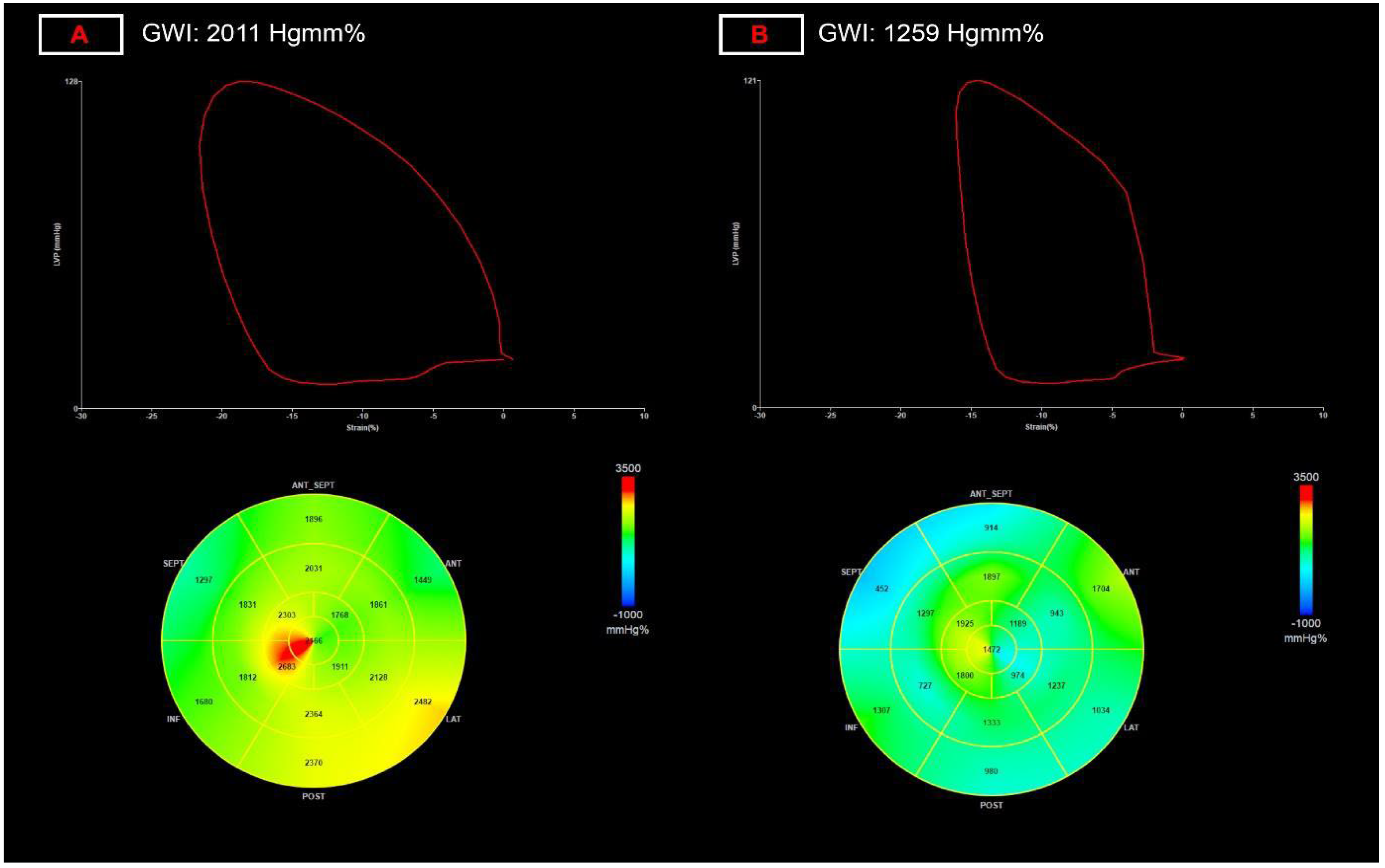 Diagnostics | Free Full-Text | Screening for Myocardial Injury after ...