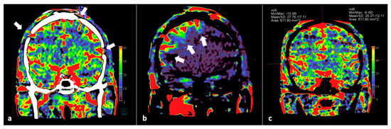 Diagnostics | An Open Access Journal from MDPI