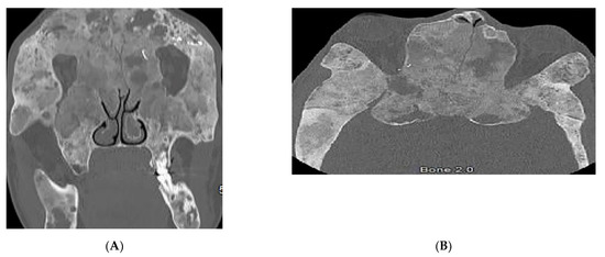 Diagnostics | Special Issue : Skeletal Radiology
