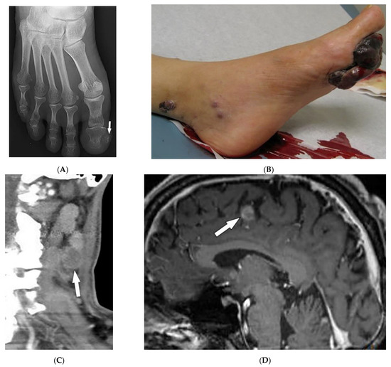 Diagnostics | Special Issue : Skeletal Radiology