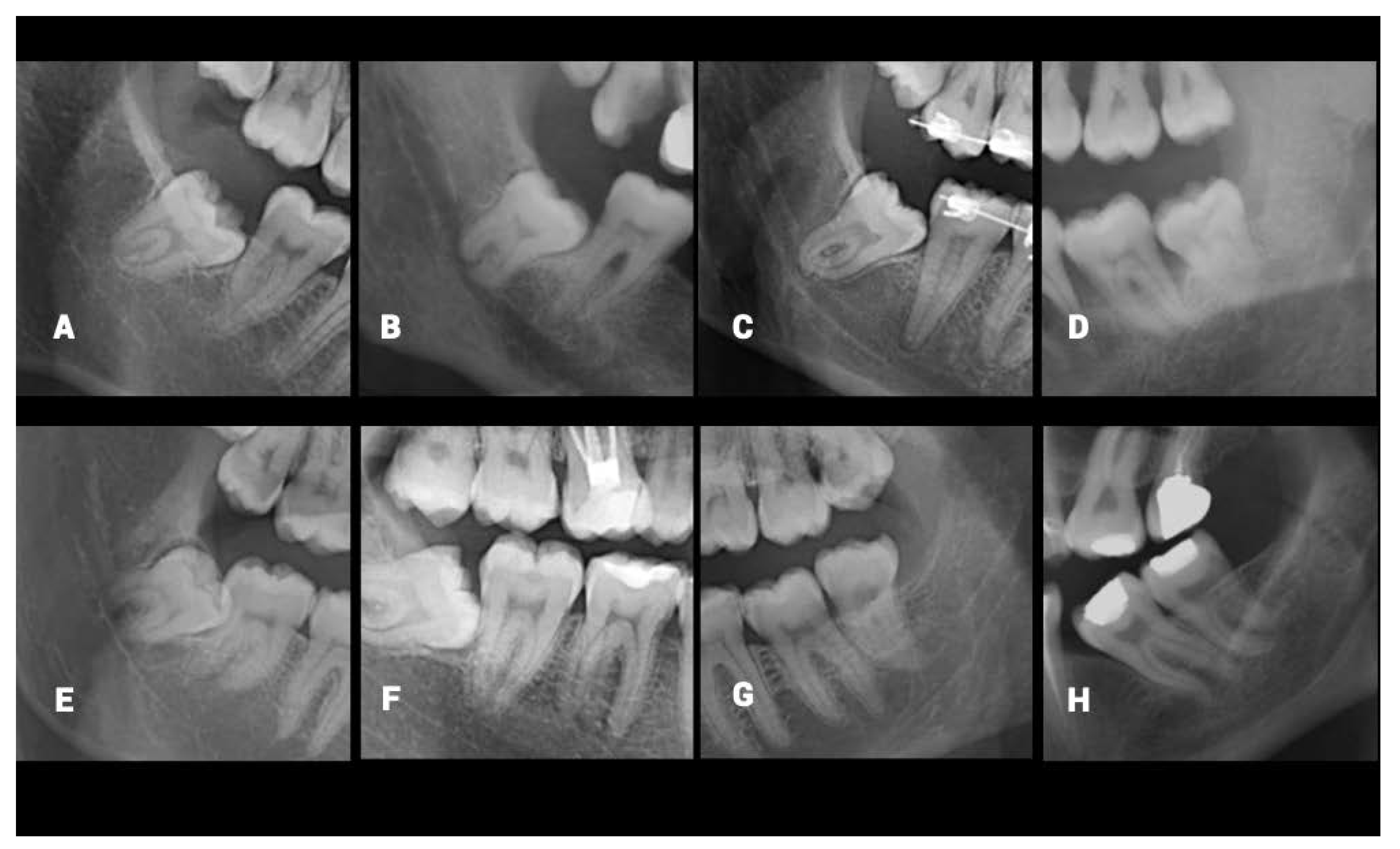 A Fused Deep Learning Architecture for the Detection of the ...